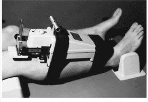 KT1000 Arthrometer - A Key Player In Testing Knee Laxity