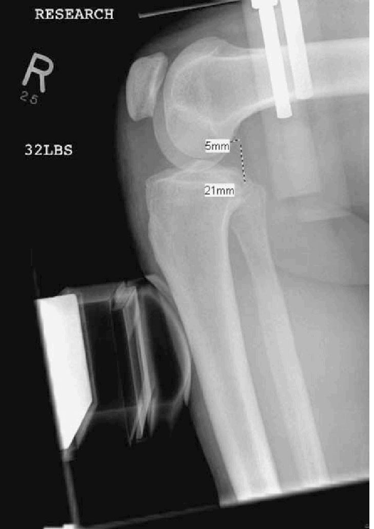 GNRB/Dyneelax Vs Telos Stress Device: Comparative Analysis