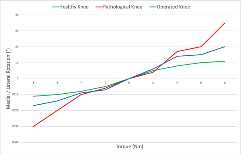 New Knee Arthrometer - Accurate Ligament Analysis | Dyneelax