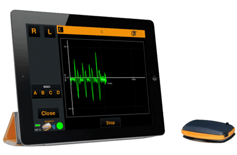 New 2024 Arthrometer Comparative Analysis: From KT-1000 To..